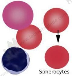 RBC Morphology Test Purpose, Procedure, Results And More | Lab Tests Guide