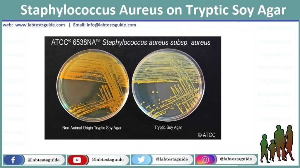 Staphylococcus Aureus Morphology Identification Bioch - vrogue.co Staphylococcus Aureus Morphology Identification Bioch - vrogue.co