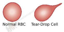 Erythrocyte Morphology Test Purpose, Procedure, Result and many more