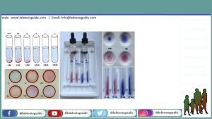 Widal Test Procedure Purpose, Procedure, Reasult and More - Lab Tests Guide