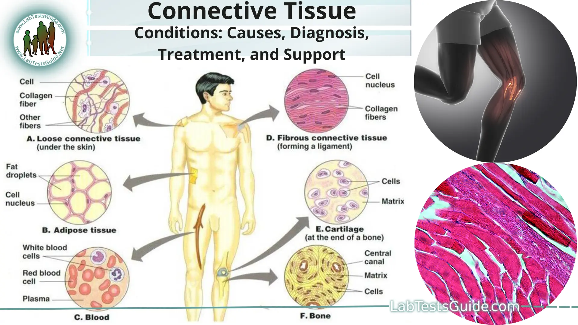 Types Of Connective Tissue In The Human Body Tissue Blog De John Fredy