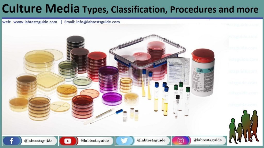 Culture Media Types, Classification, Procedures and more - Lab Tests Guide