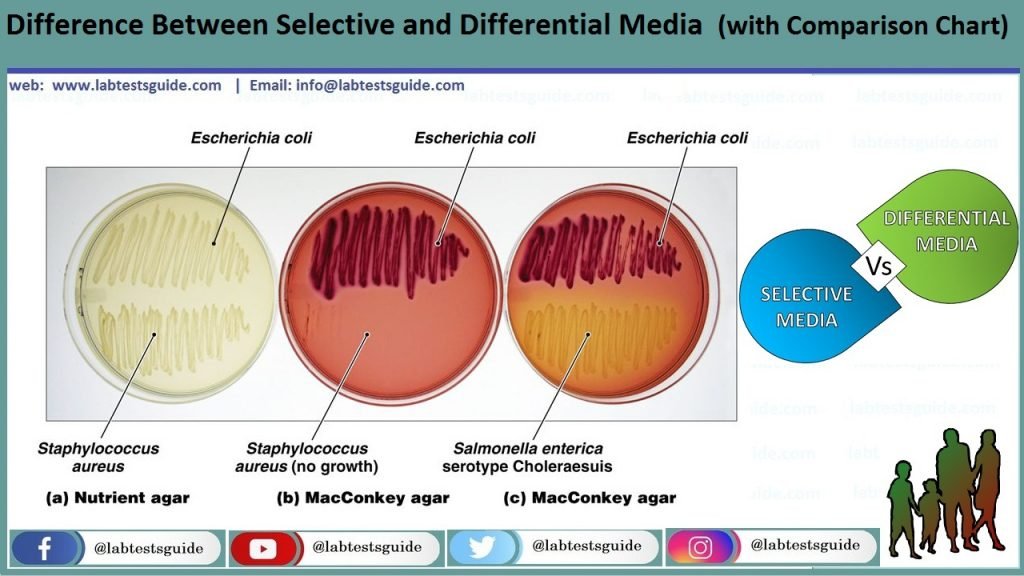 Difference Between Selective and Differential Media with Comparison ... Difference Between Selective and Differential Media with Comparison ...
