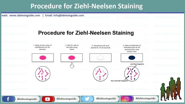 Z. N Staining Uses, Procedure, Results and More | Lab Tests Guide