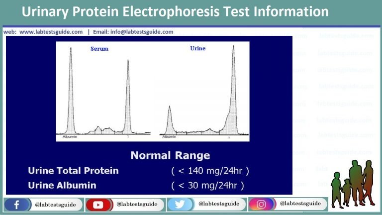 Urinary Protein Electrophoresis Test Information - Lab Tests Guide