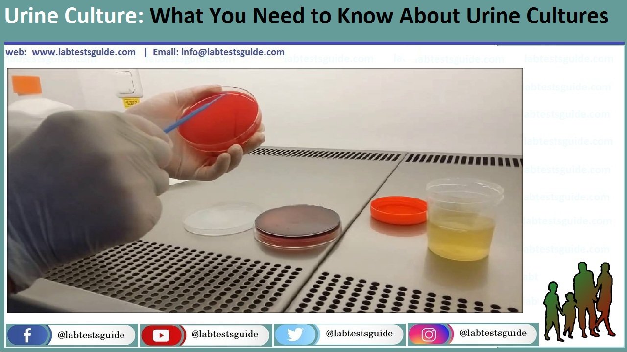 Urine Culture What You Need To Know About Urine Cultures Lab Tests Guide