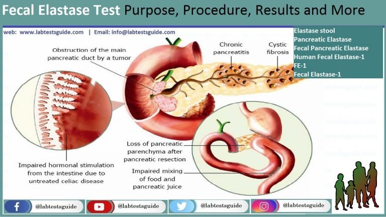 Normal Pancreatic Enzyme Levels