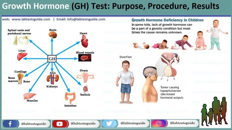 Growth Hormone Test | Lab Tests Guide