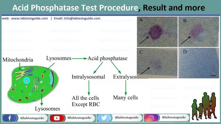 Acid Phosphatase Test Procedure, Result And More | Lab Tests Guide
