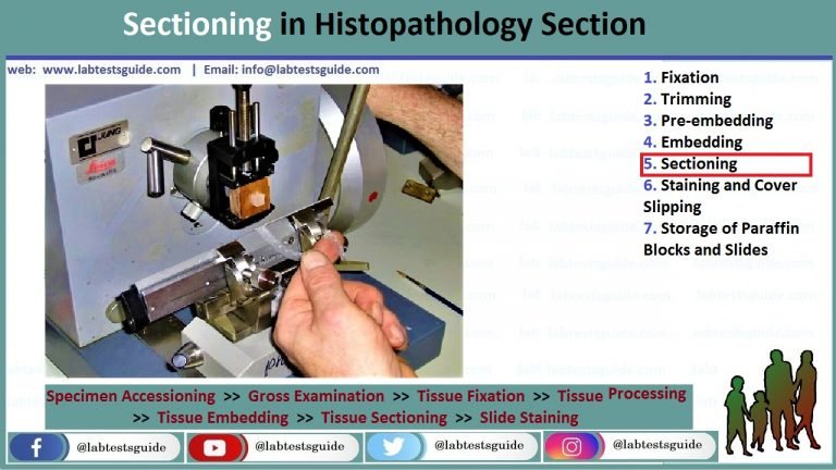 Sectioning (Histopathology) Step In Histopathology Procedure | Lab ...