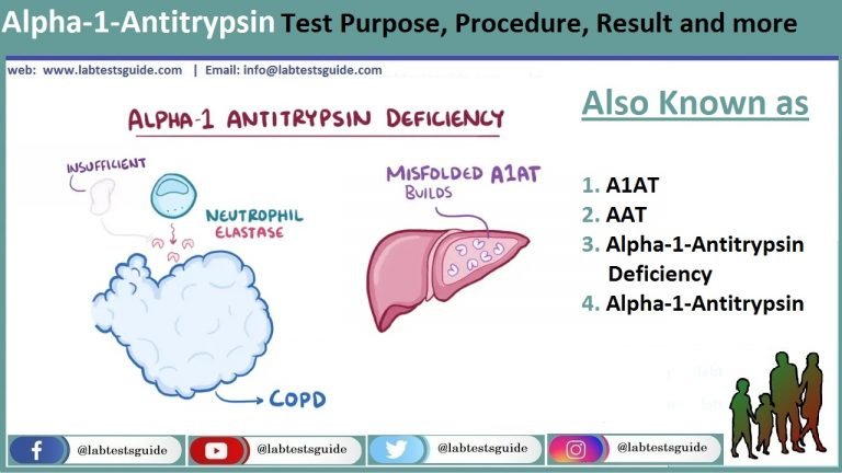 Alpha-1-Antitrypsin Deficiency Test Purpose, Procedure, Result And More ...