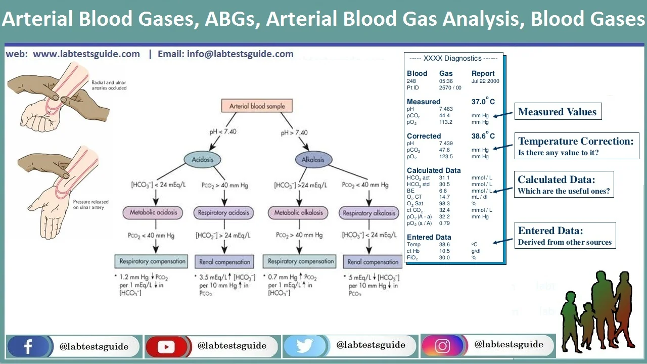 Base Excess | Lab Tests Guide