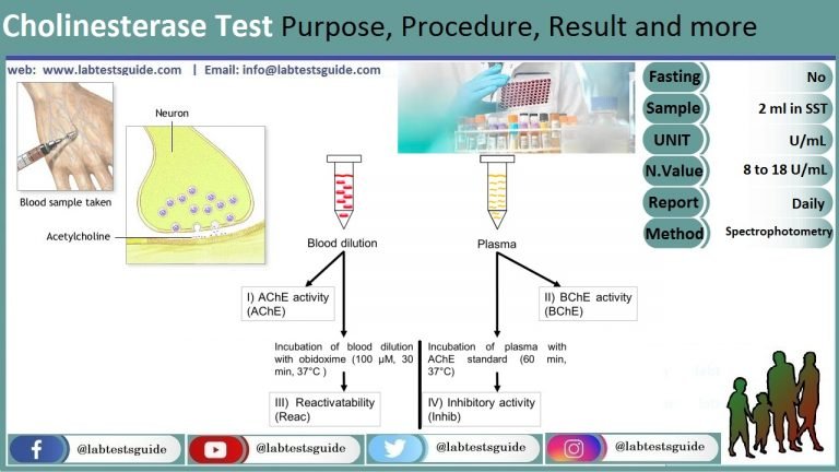 RBC Cholinesterase Test Purpose, Procedure, Result and more - Lab Tests ...