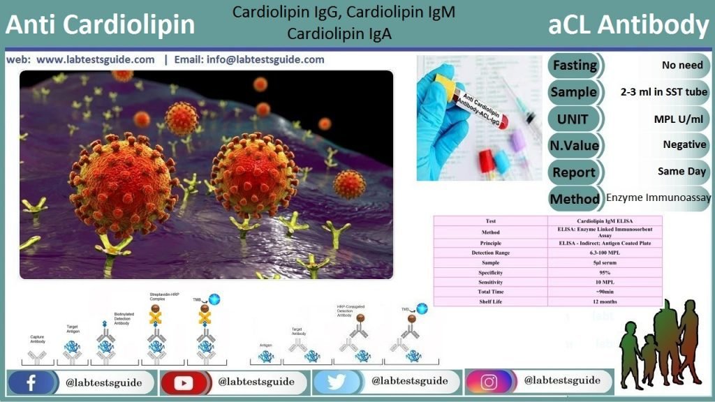 aCL Antibody Purpose, Procedure, Result and more | Lab Tests Guide