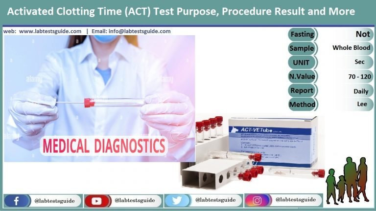ACT Test Purpose, Procedure, Results and more - Lab Tests Guide
