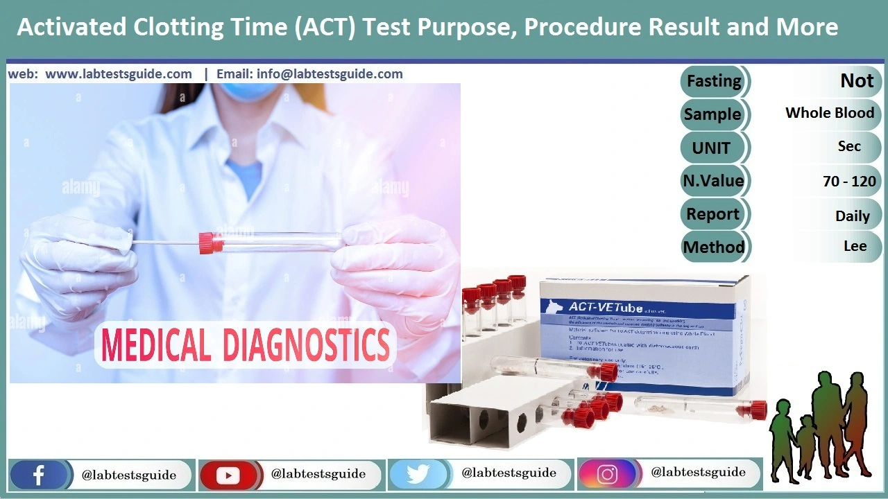 Activated Clotting Time Test Purpose Procedure Result And More Activated Clotting Time Test Purpose Procedure Result And More