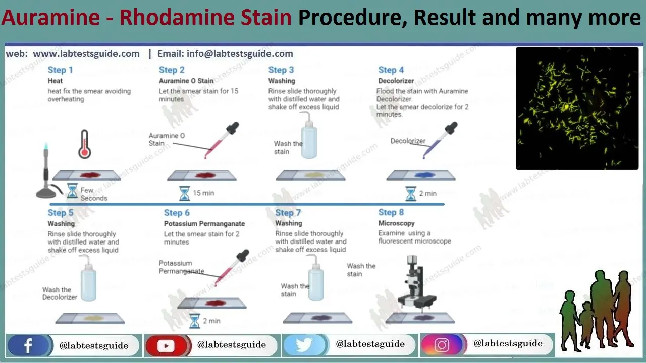 Auramine and Rhodamine Stain Purpose, Procedure, Result Interpretation ...