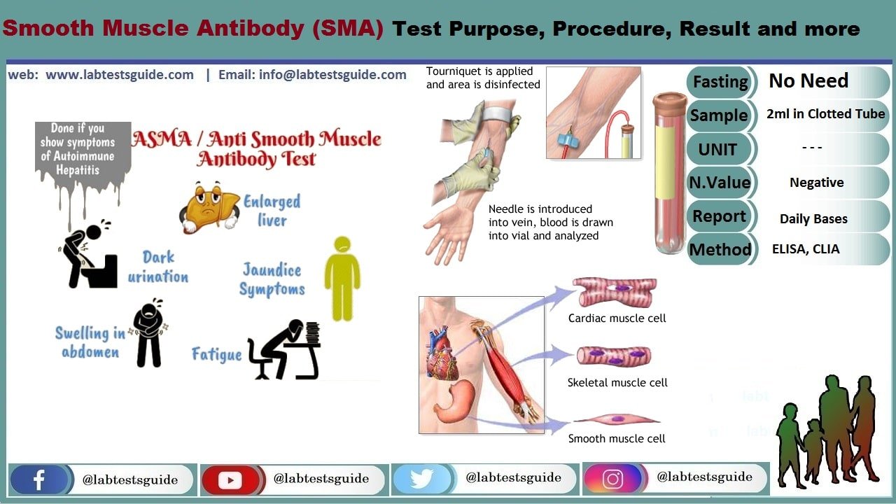 Smooth Muscle Antibody Titers Test Purpose, Procedure, Result And More ...