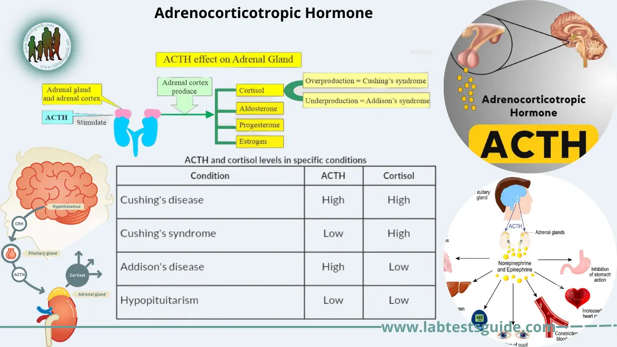 Adrenocorticotropic Hormone Test Purpose, Procedure, Results and more