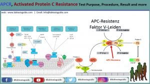 APC Resistance Test Purpose, Procedure, Result and more | Lab Tests Guide