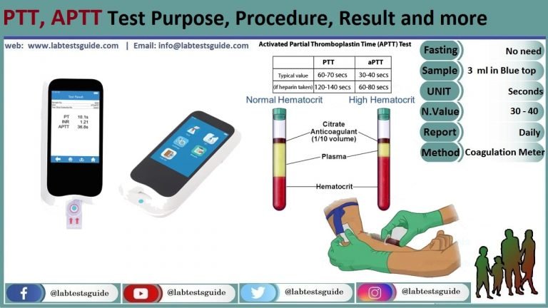 Activated Partial Thromboplastin Time (APTT) Test Purpose, Procedure ...