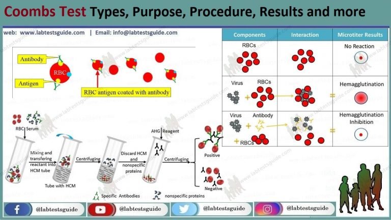Coombs Test Types, Purpose, Procedure, Results and more | LTG