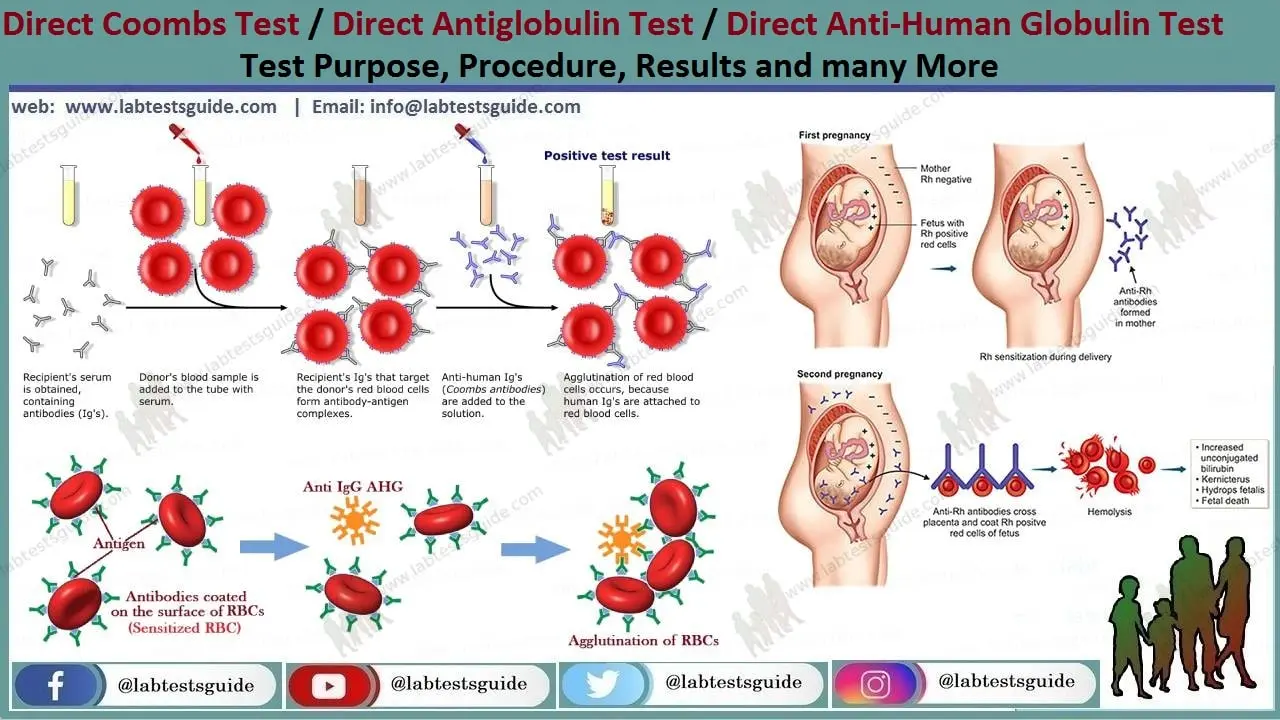 Direct Anti-human Globulin Test (DAT): Everything you need to know