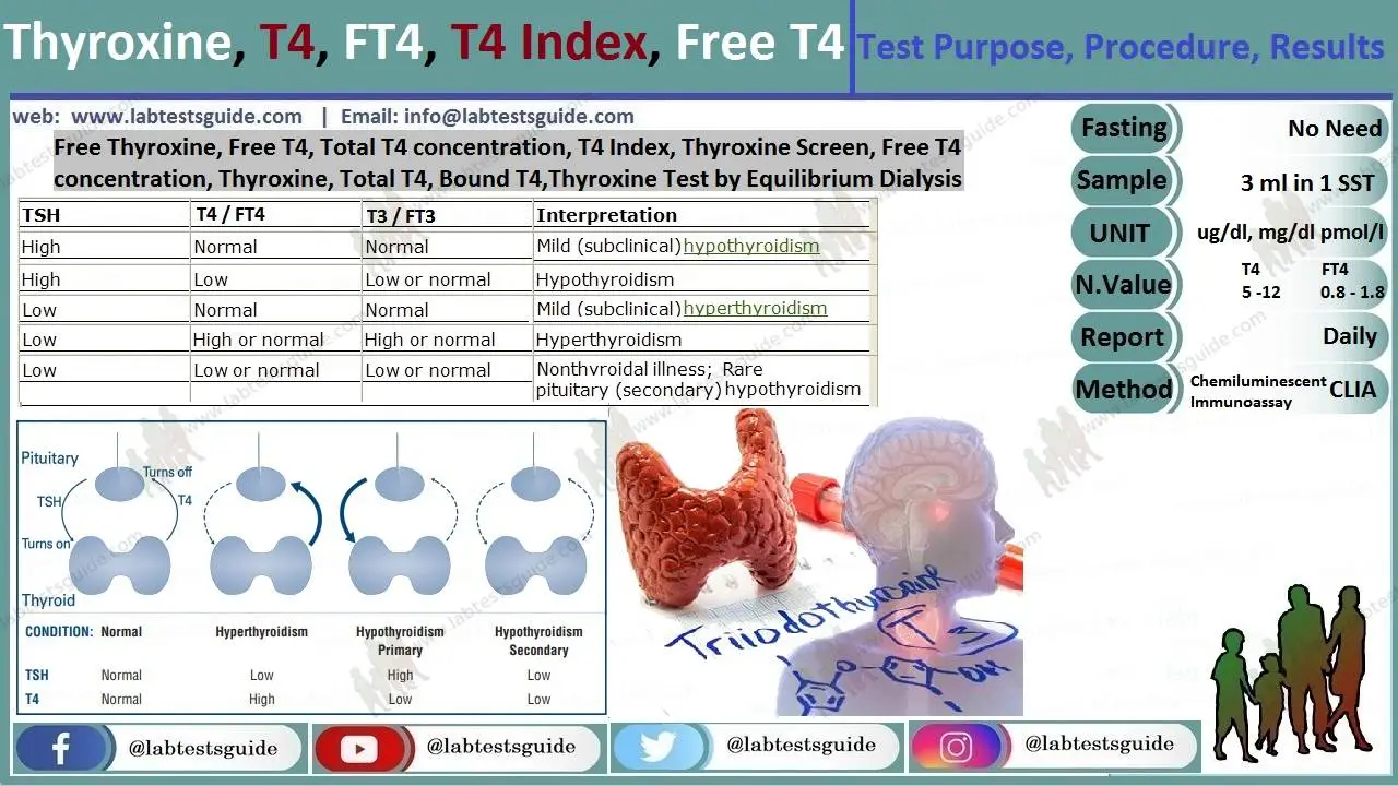 Free T4 Concentration Test Purpose, Procedure, Result Interpretation ...