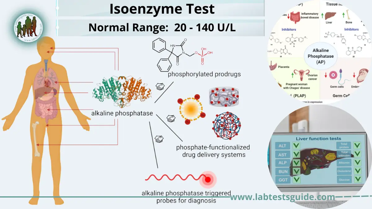 Isoenzyme Test Test Purpose, Procedure, Results Interpretation and more