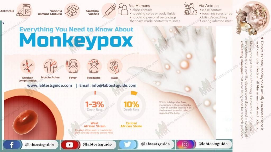 Monkeypox Symptoms, Causes, Prevention and more | Lab Tests Guide