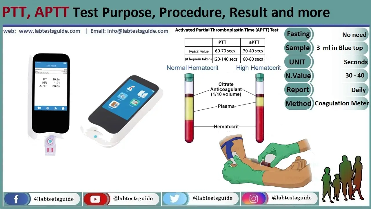 PTT (Partial thromboplastin time) | Lab Tests Guide