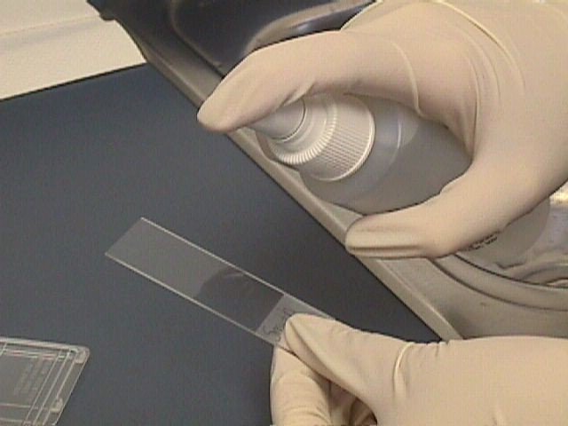 PAP Stain Procedure, Result, Interpretation and more| LTG