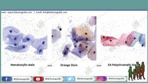 PAP Stain Procedure, Result, Interpretation And More| LTG