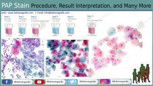 PAP Stain Procedure, Result, Interpretation And More| LTG