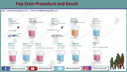 PAP Stain Procedure, Result, Interpretation And More| LTG