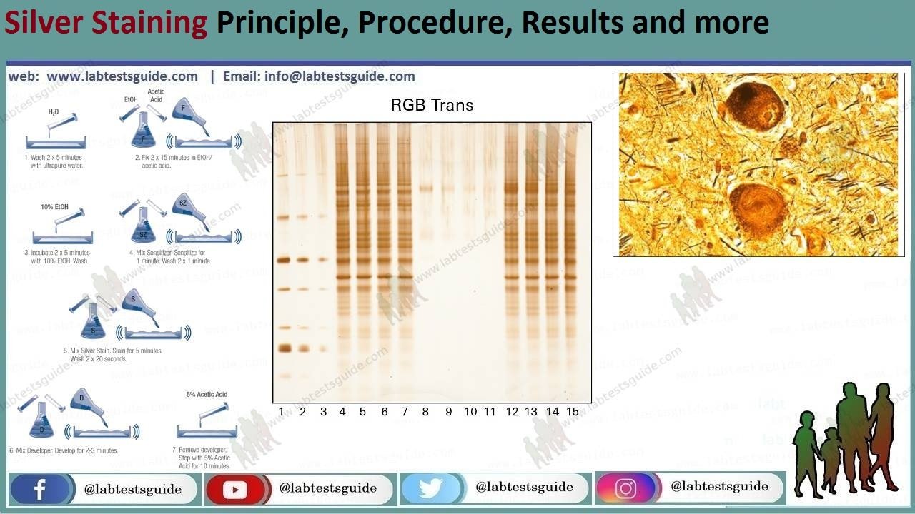 Chemicals & Stains | Lab Tests Guide