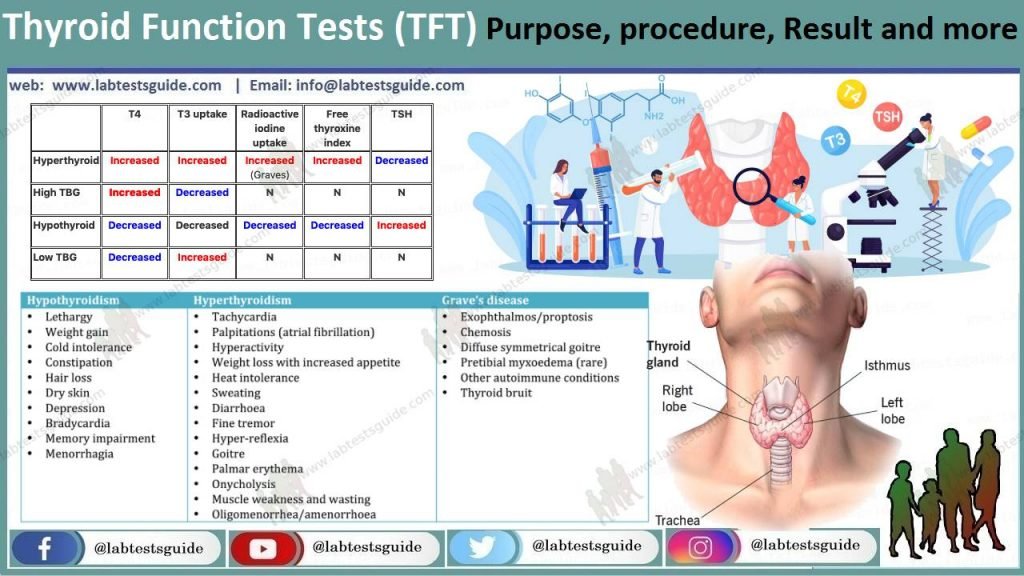 Thyroid Profile Tests Purpose Procedure Result And More Lab Tests Guide