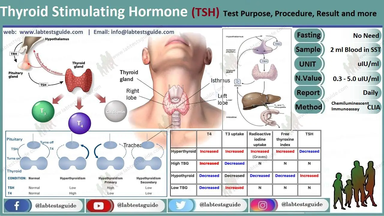 Thyroid Stimulating Hormone Test Purpose, Procedure, Result, 60% OFF Thyroid Stimulating Hormone Test Purpose, Procedure, Result, 60% OFF