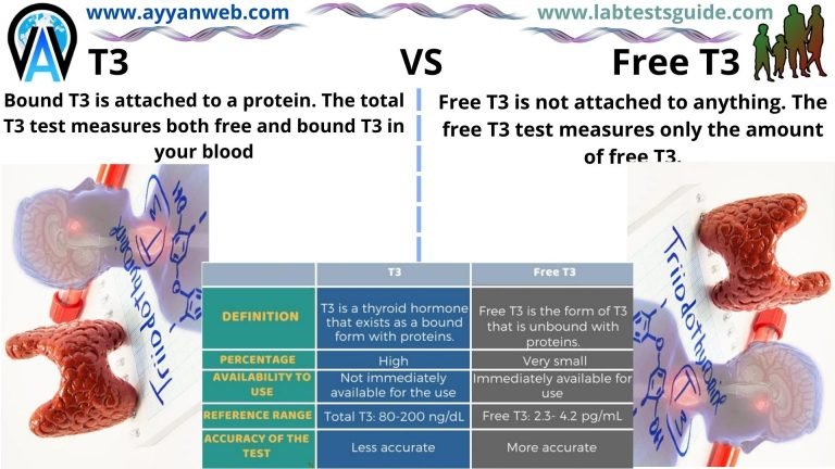 Overactive Thyroid Symptoms, Causes, Diagnosis And More | LTG