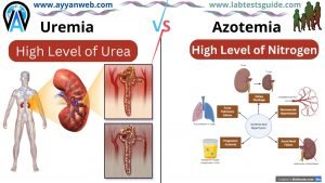 Difference Between | Lab Tests Guide