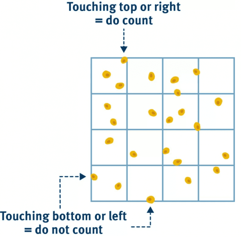 Neubauer Chamber Uses, Procedures, Calculations And More| LTG