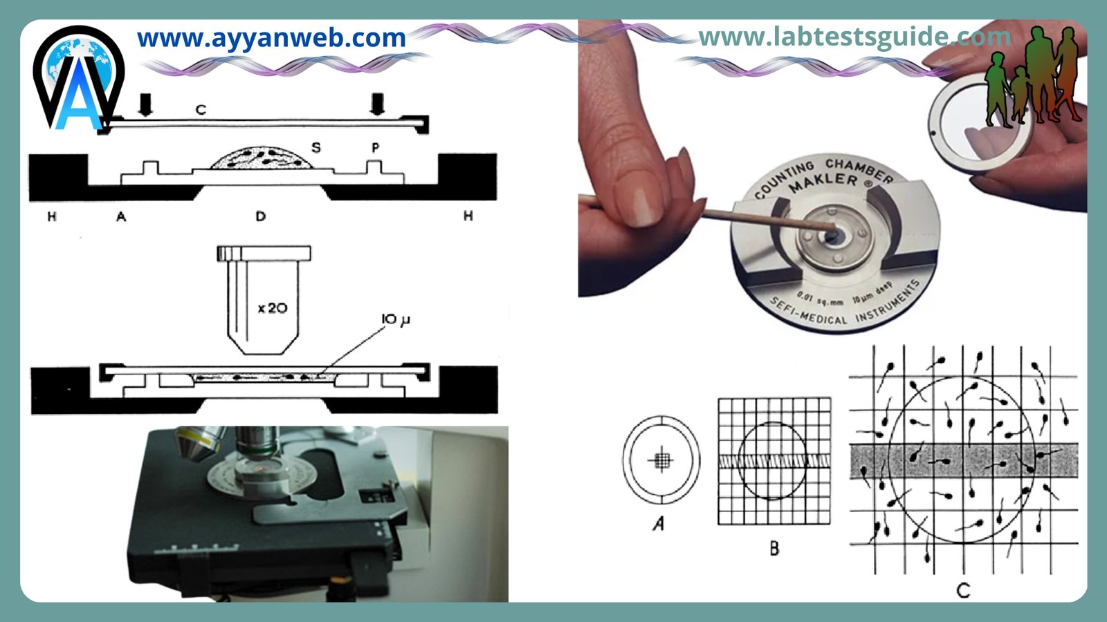 Makler Counting Chamber Features, Procedure And More | LTG