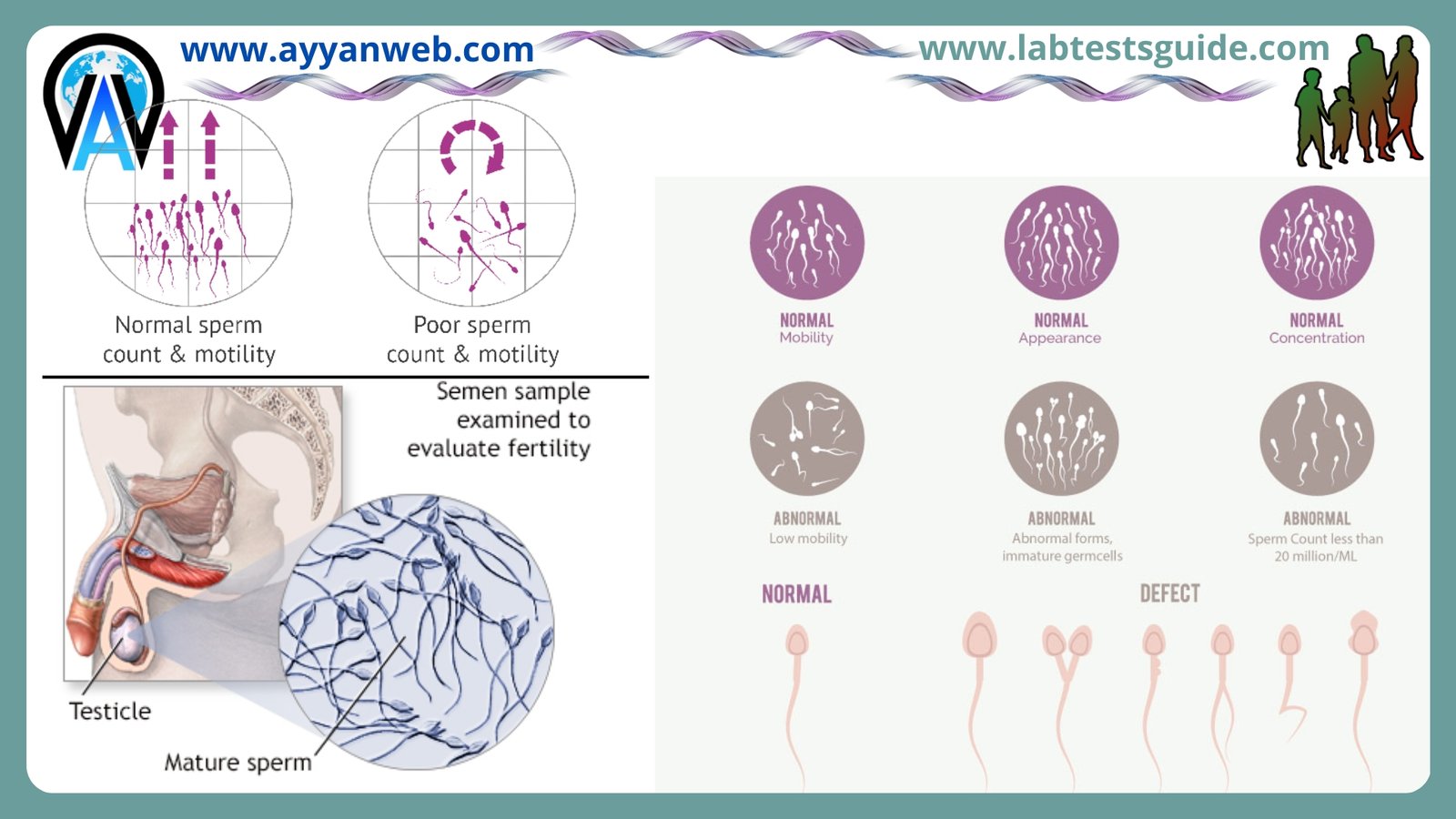 Semen Analysis Test Defination, Purpose, Results And More