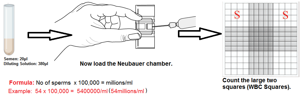 Semen Analysis Procedure