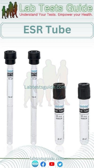 Blood Collection Tubes , Types, Usage And More | Lab Tests Guide