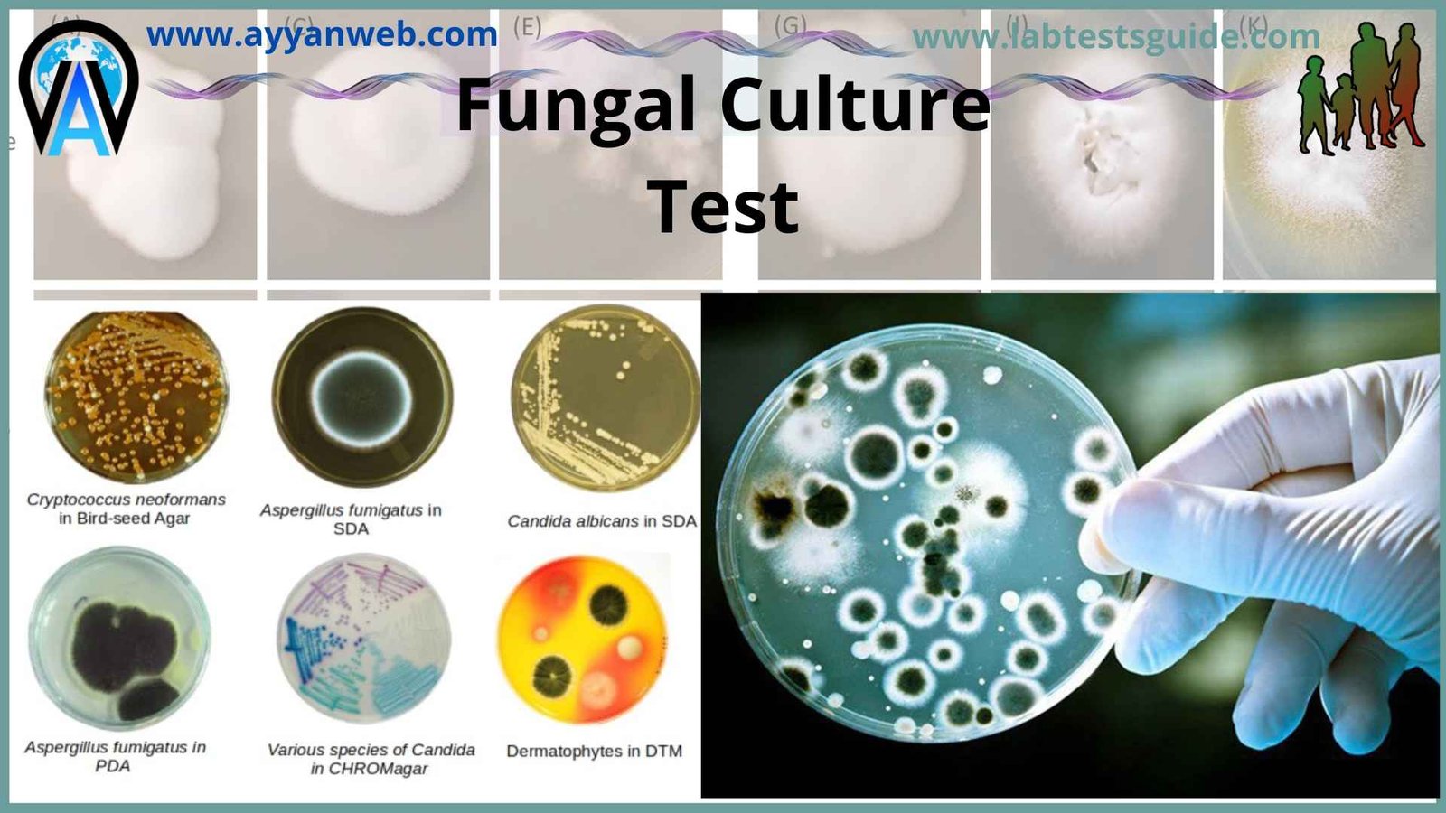 Fungal Culture Purpose, Procedure, Results And More | LTG