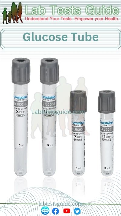 Blood Collection Tubes , Types, Usage And More | Lab Tests Guide
