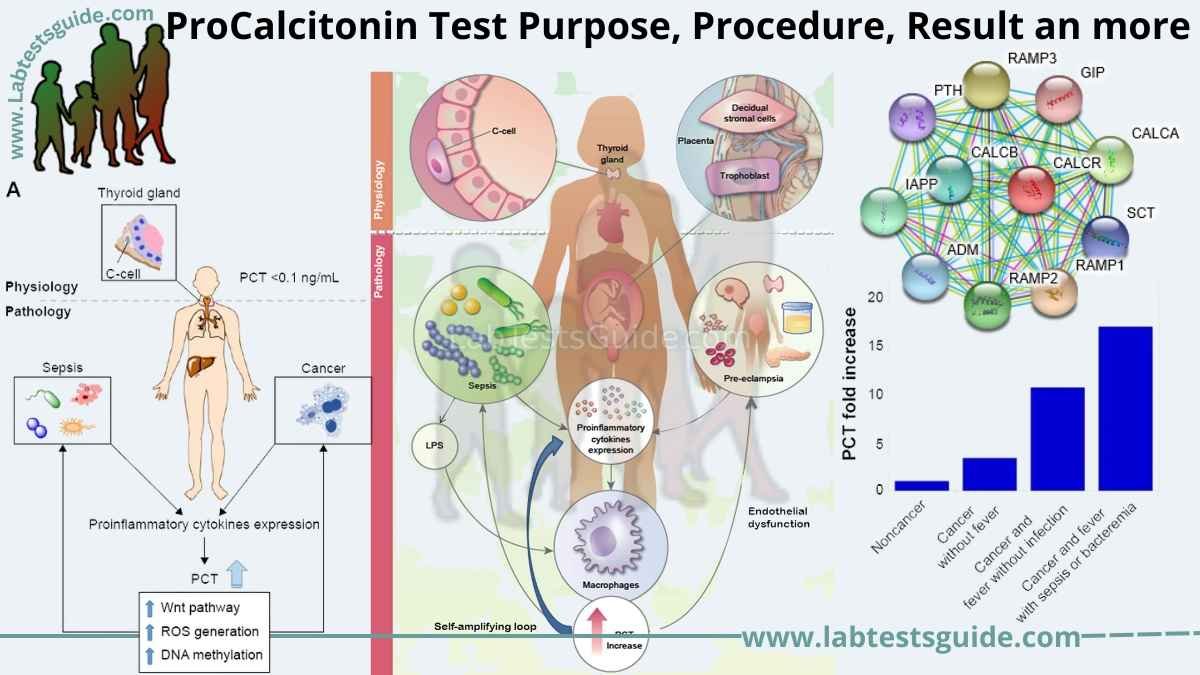 Procalcitonin Test Purpose, Procedure, Result And More | LTG