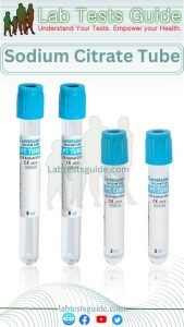 Blood Collection Tubes , Types, Usage And More | Lab Tests Guide