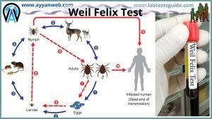 PO2 Test Purpose, Procedure, Result And More | Lab Tests Guide